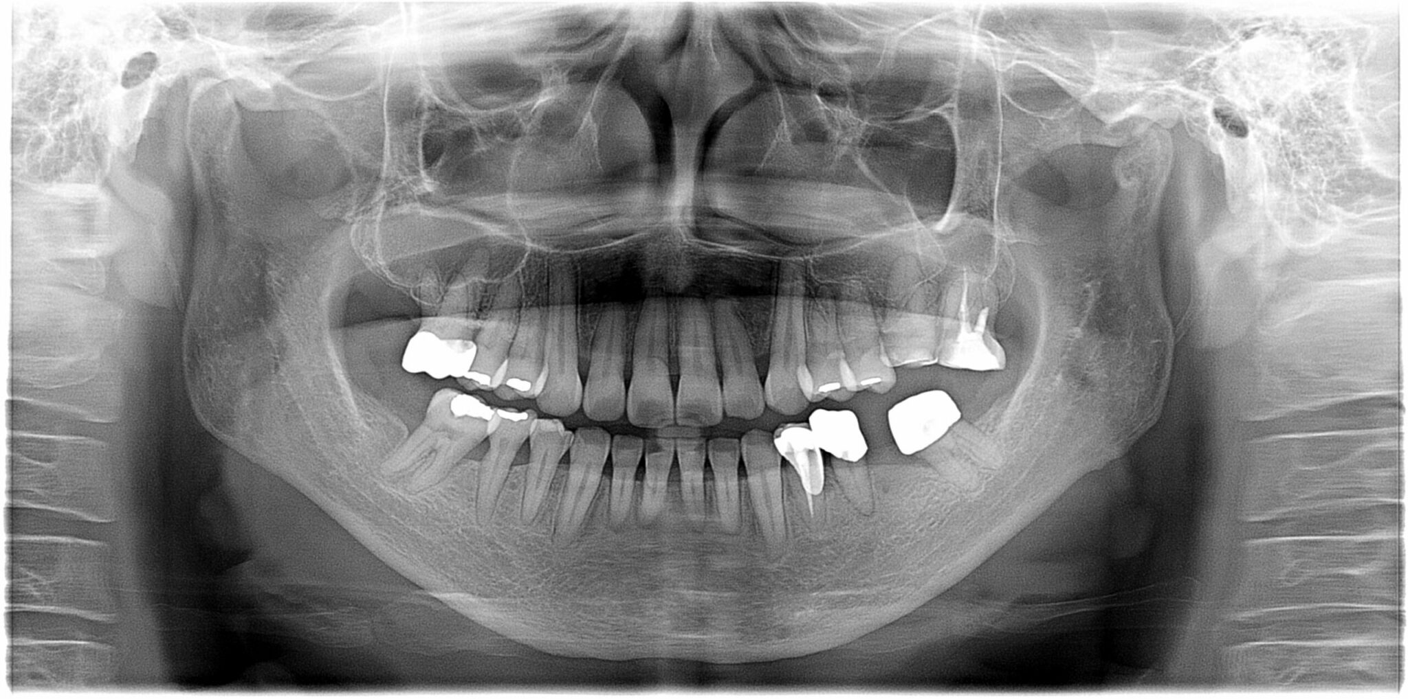 Rayscan Alpha - F1 Dentalsysteme