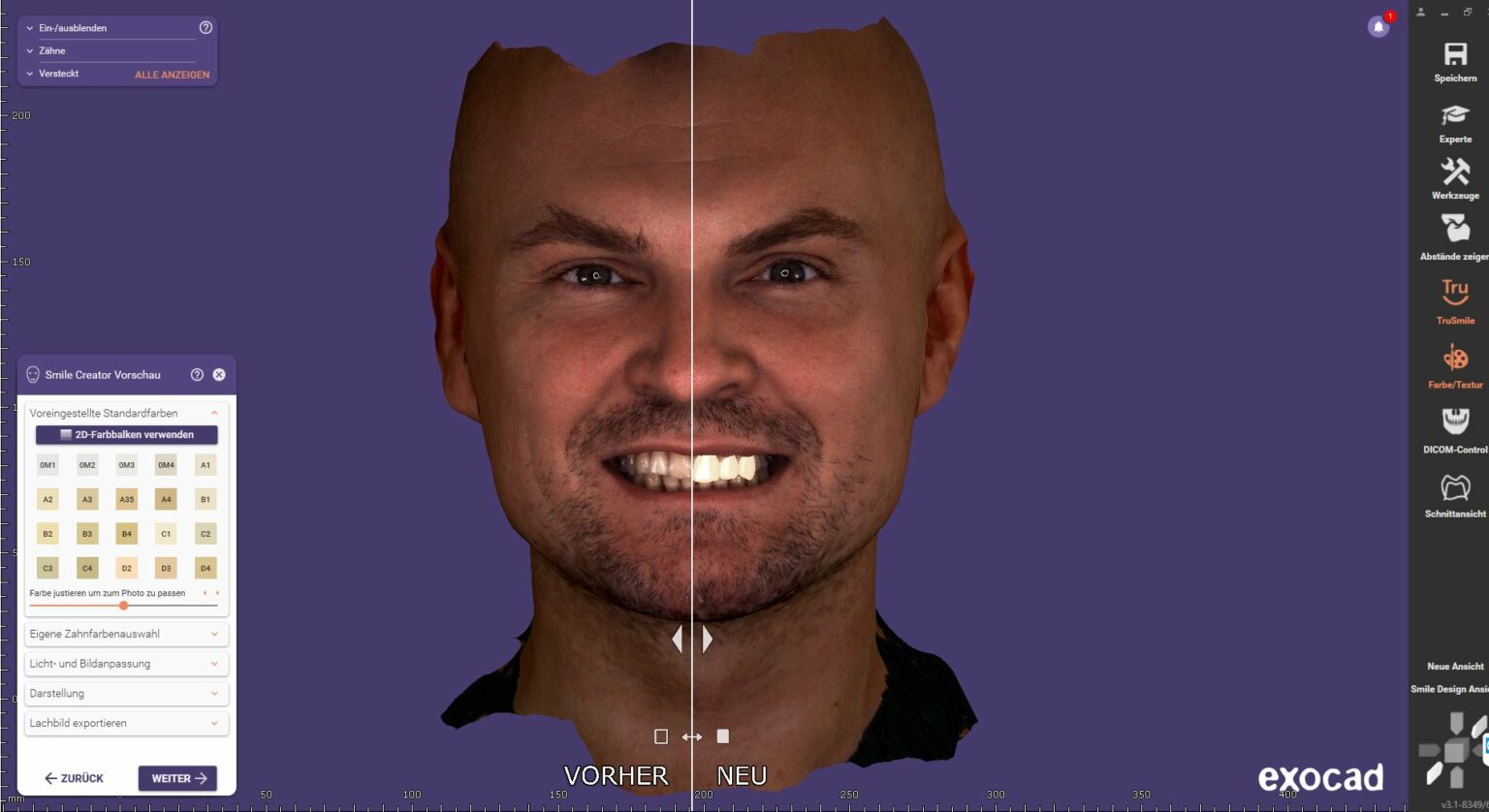 RAYFACE 200 – NEU! - F1 Dentalsysteme