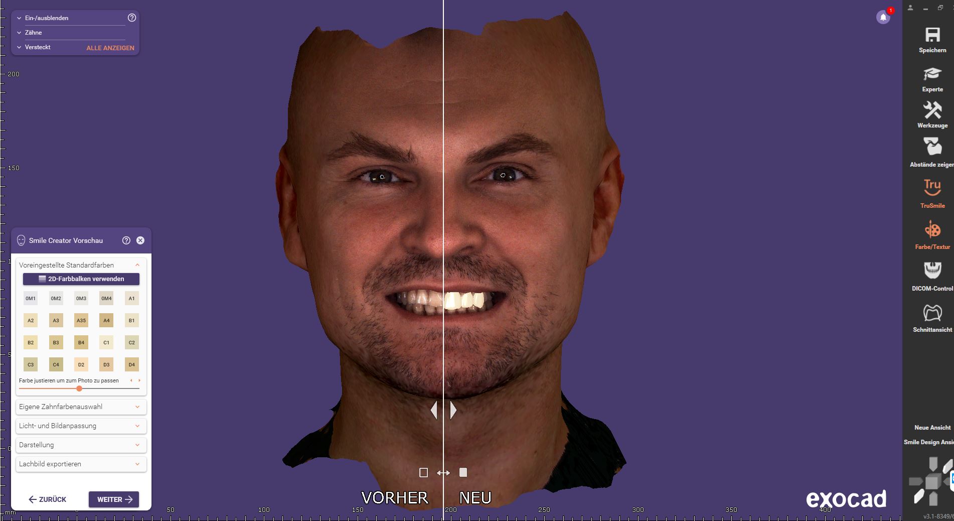 RAYFACE 200 – NEU! - F1 Dentalsysteme