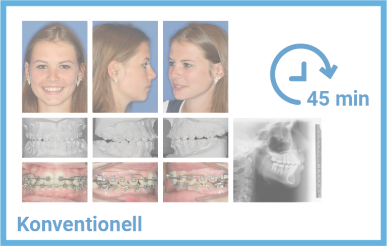 RAYFACE 200 – NEU! - F1 Dentalsysteme